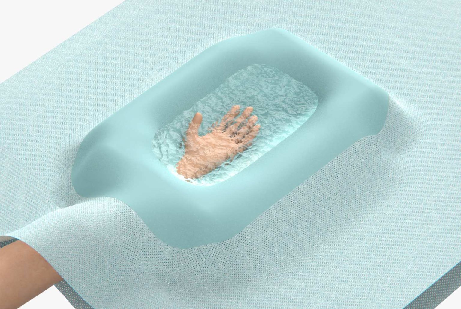 Spirecut – Treat carpal tunnel syndrome and trigger finger